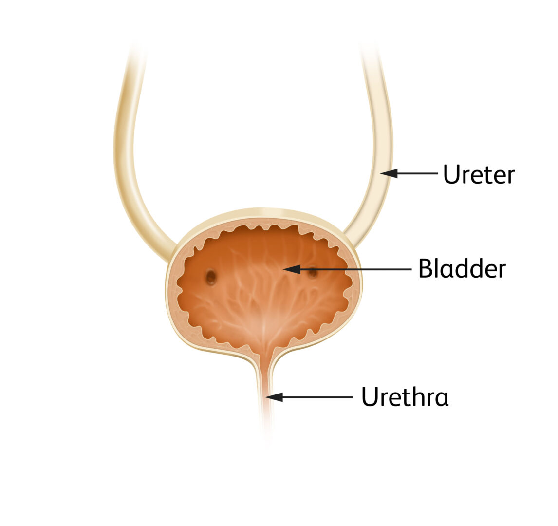Female Urinary Incontinence - Purewick